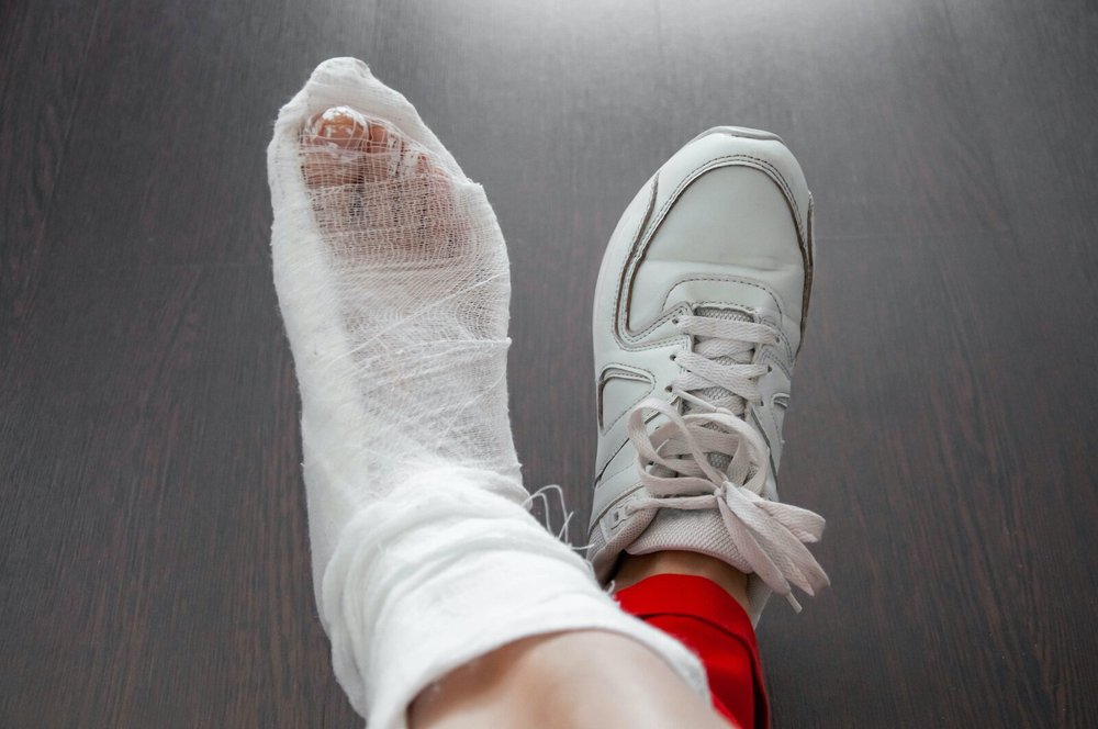 Bunion Surgery Recovery: What To Expect and How To Prepare — Snug Safety