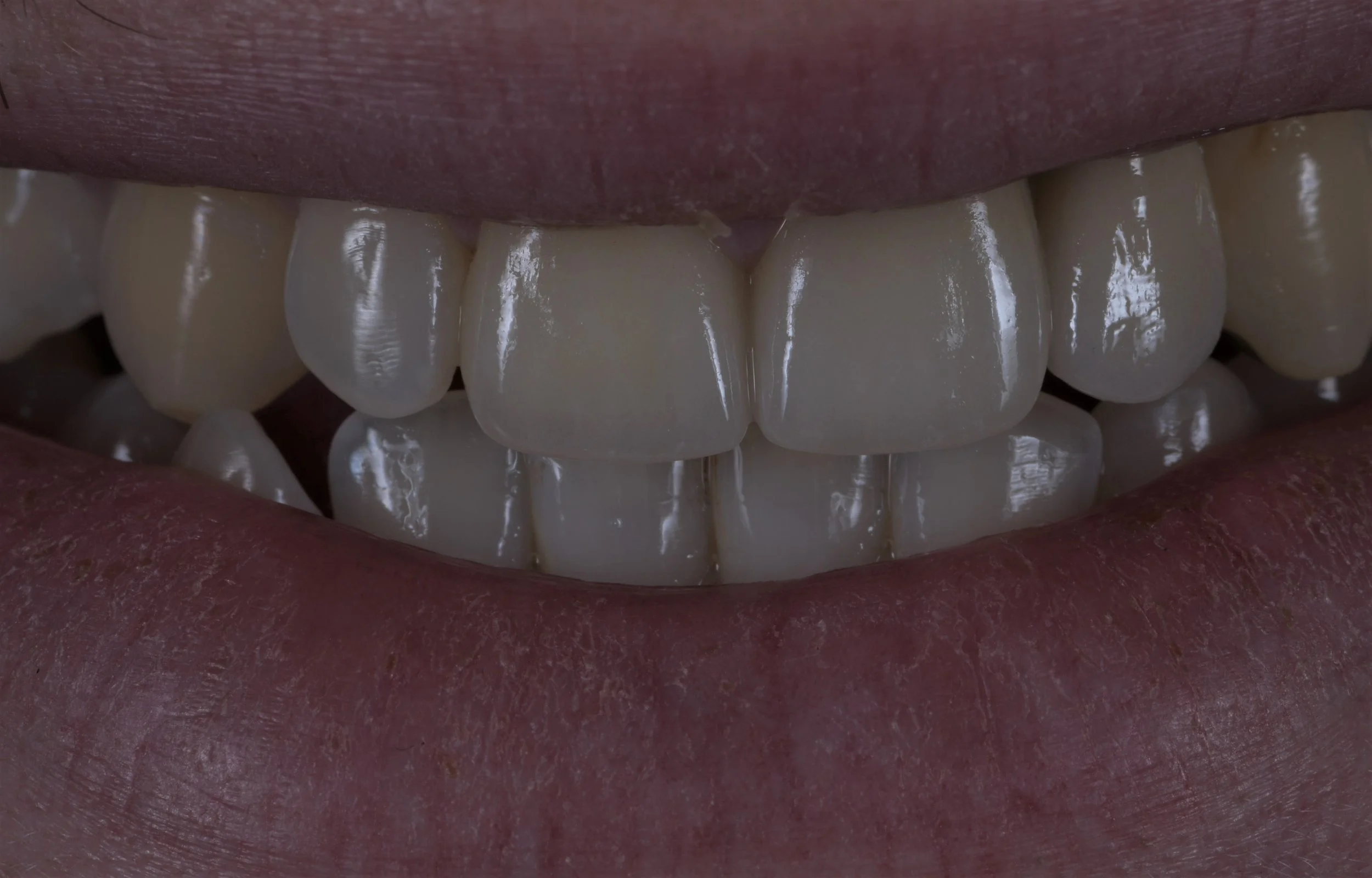 Restorative Dentistry