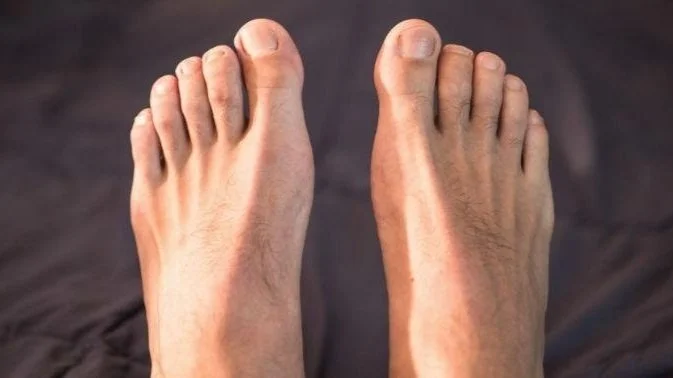 Pediatric Foot Specialist | Paediatric Podiatrist — Sky Podiatry