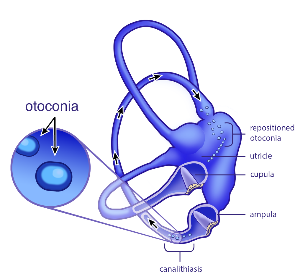 DizzyFIX | Vertigo & BPPV Relief – DizzyFIX