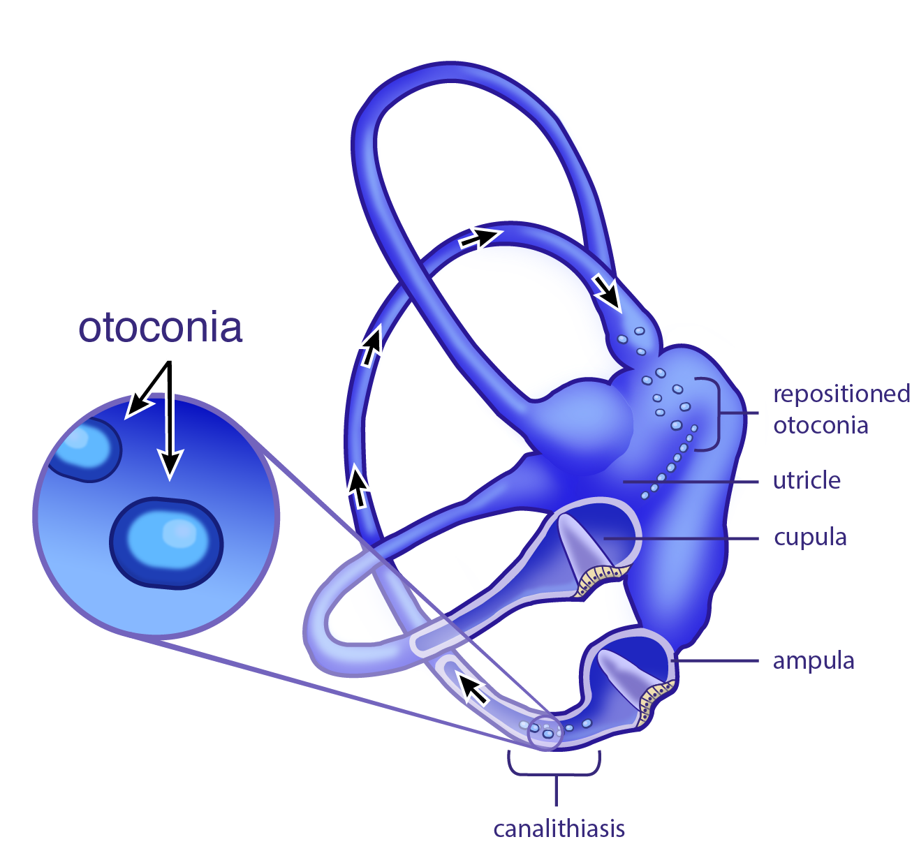DizzyFIX | Vertigo & BPPV Relief – DizzyFIX