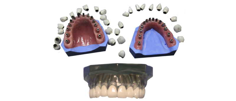 Implants — GCDL