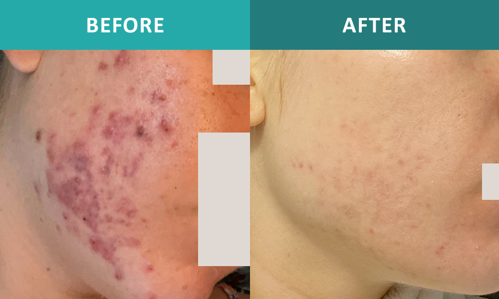 Holistic Dermatology, Naturopathic Doctor, Integrative Dermatologist