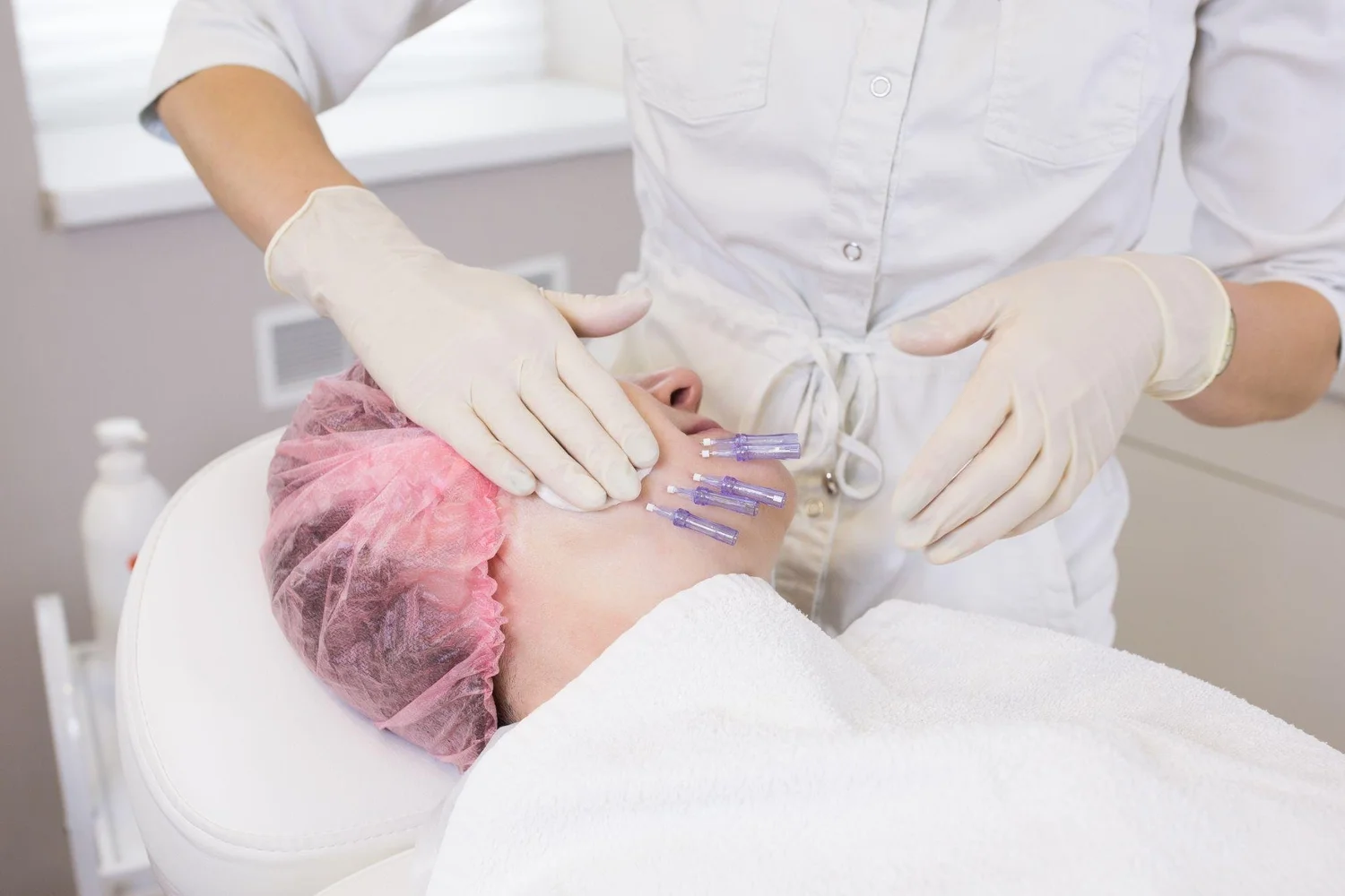 Face Thread Lift in Chattanooga: Get Instant Lift With Precision ...