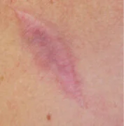 Common Scar Problems — Scar Team