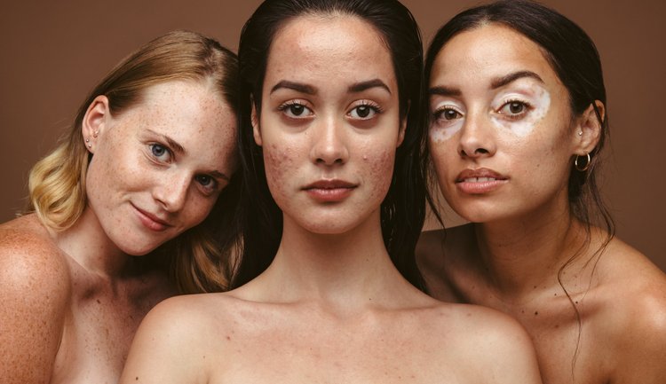 Understanding Different Skin Types and How to Care for Them — Elemental ...