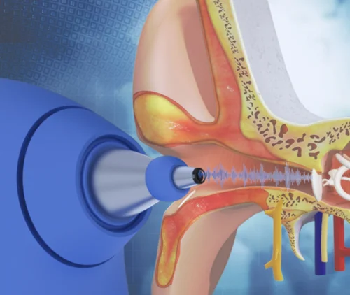 Ultrasound Ear Otoscope Middle Ear Infections