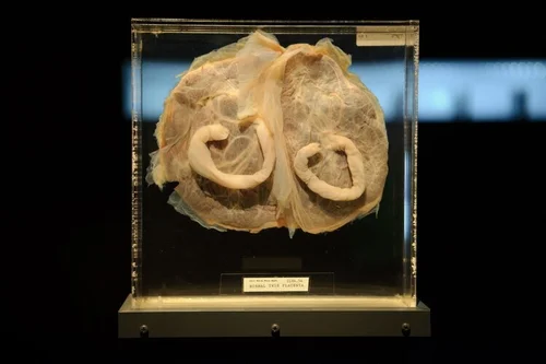HUMAN PLACENTA SPECIMEN — Science Gallery Melbourne