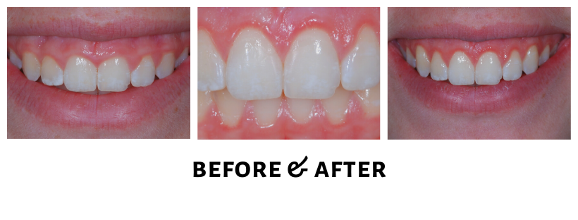 Dental Cosmetic Surgery in Maine — COREY+THEN