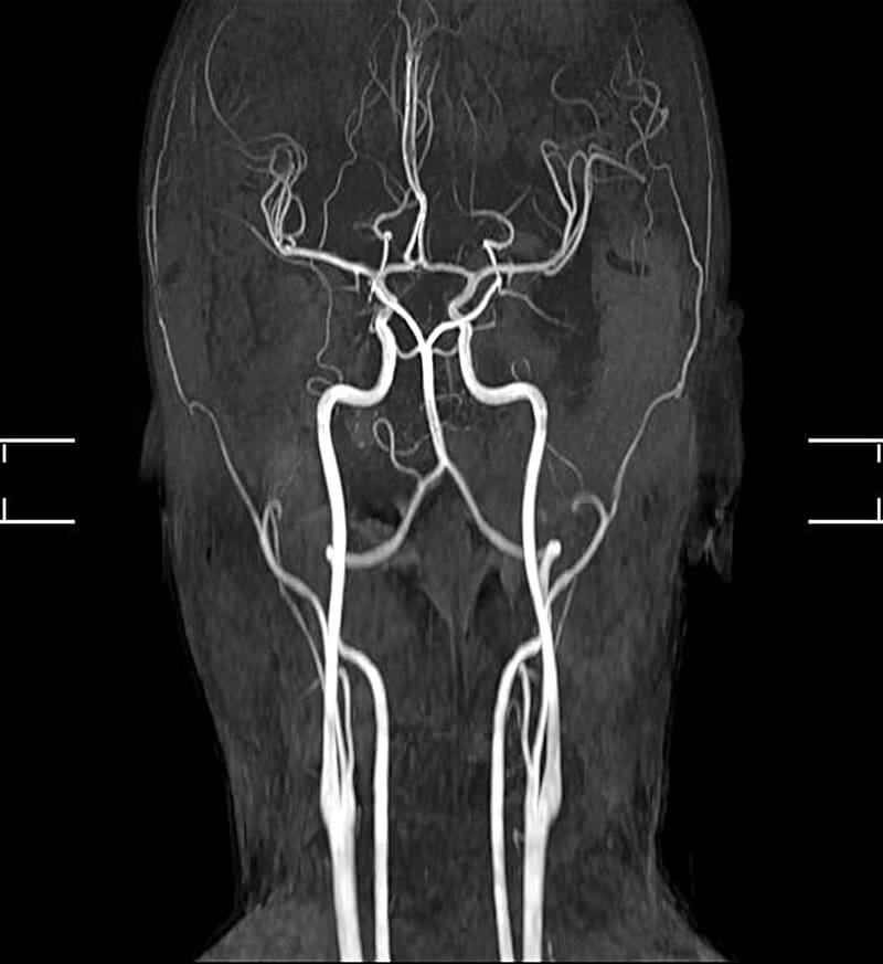 MRI | Book Your Scan Today — Rezolut