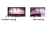 `My Invisalign Diary Weeks 1 - 21 — Homegirl Hygienist