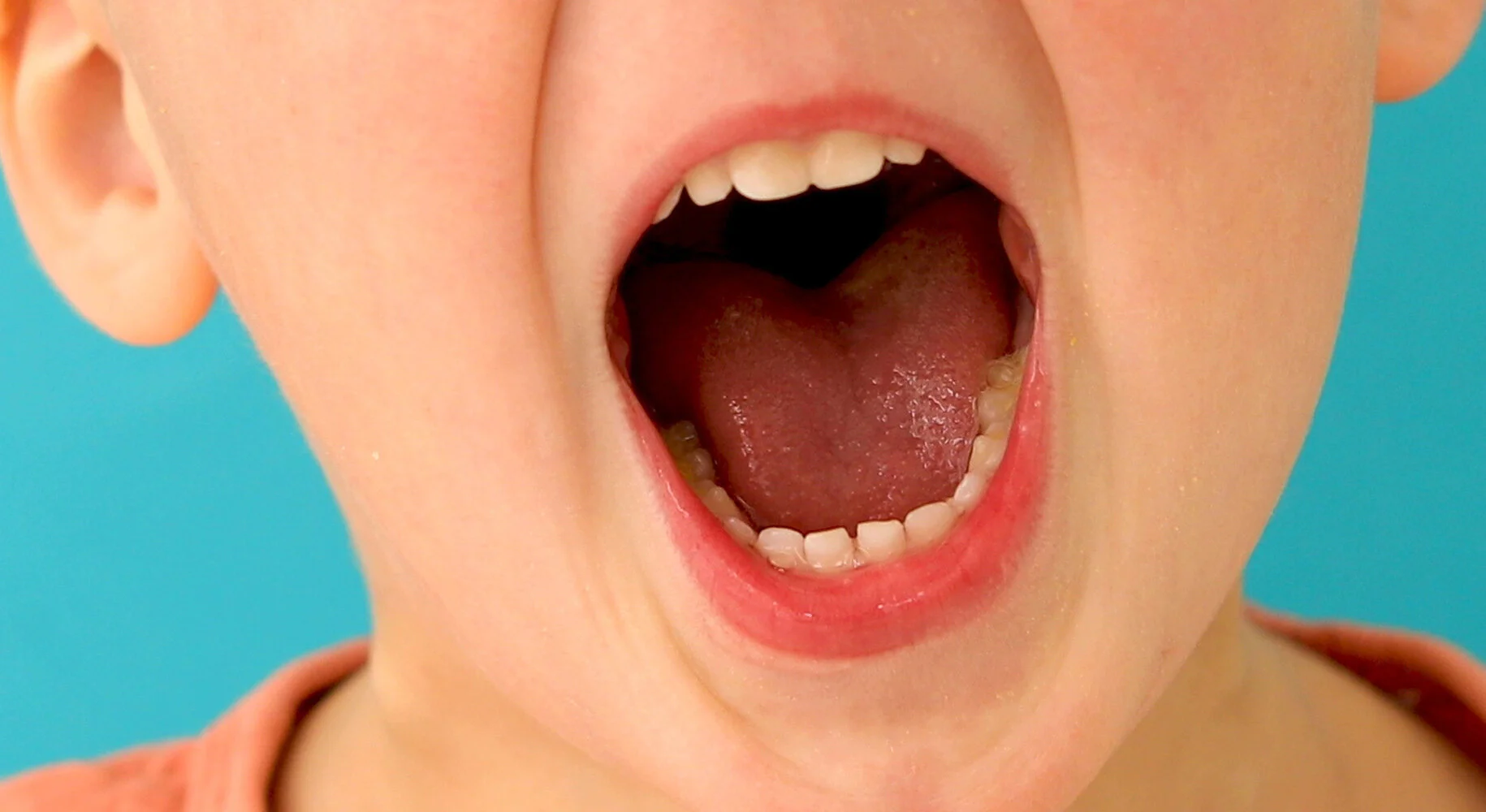 Orofacial Myology — Miller Therapy LLC