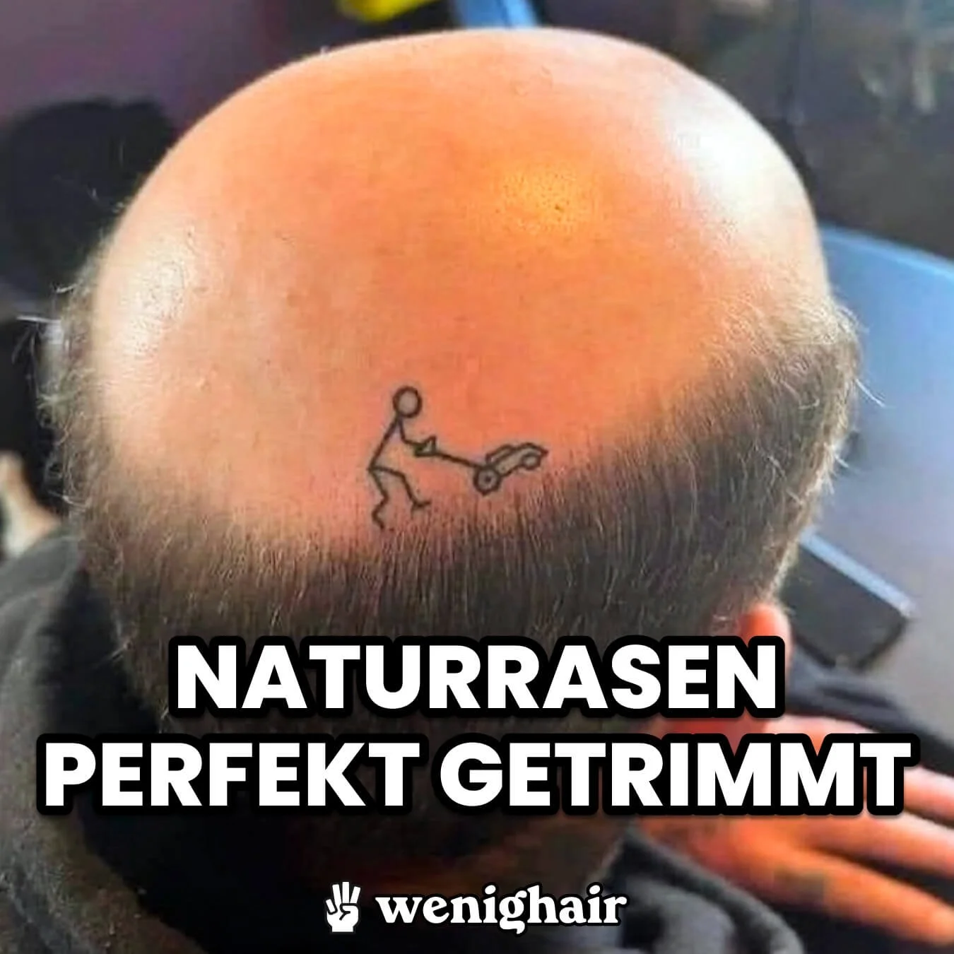 Glatze Meme F r Alle Die Oben Ohne Gehen Hahaha