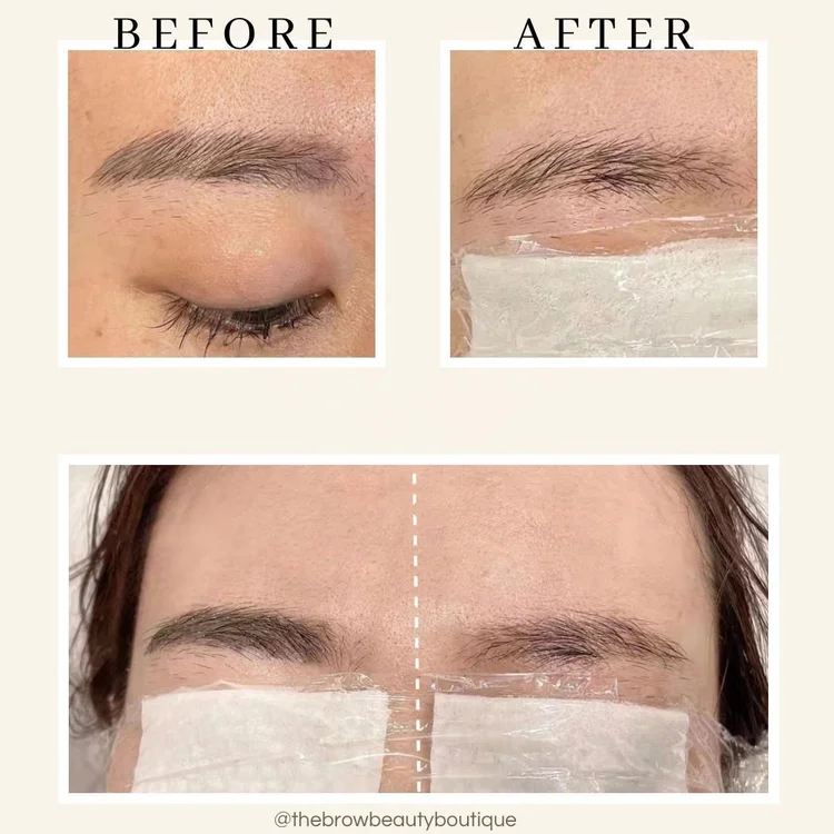 Factors Behind Botched Eyebrow Embroidery: Navigating the Pitfalls ...