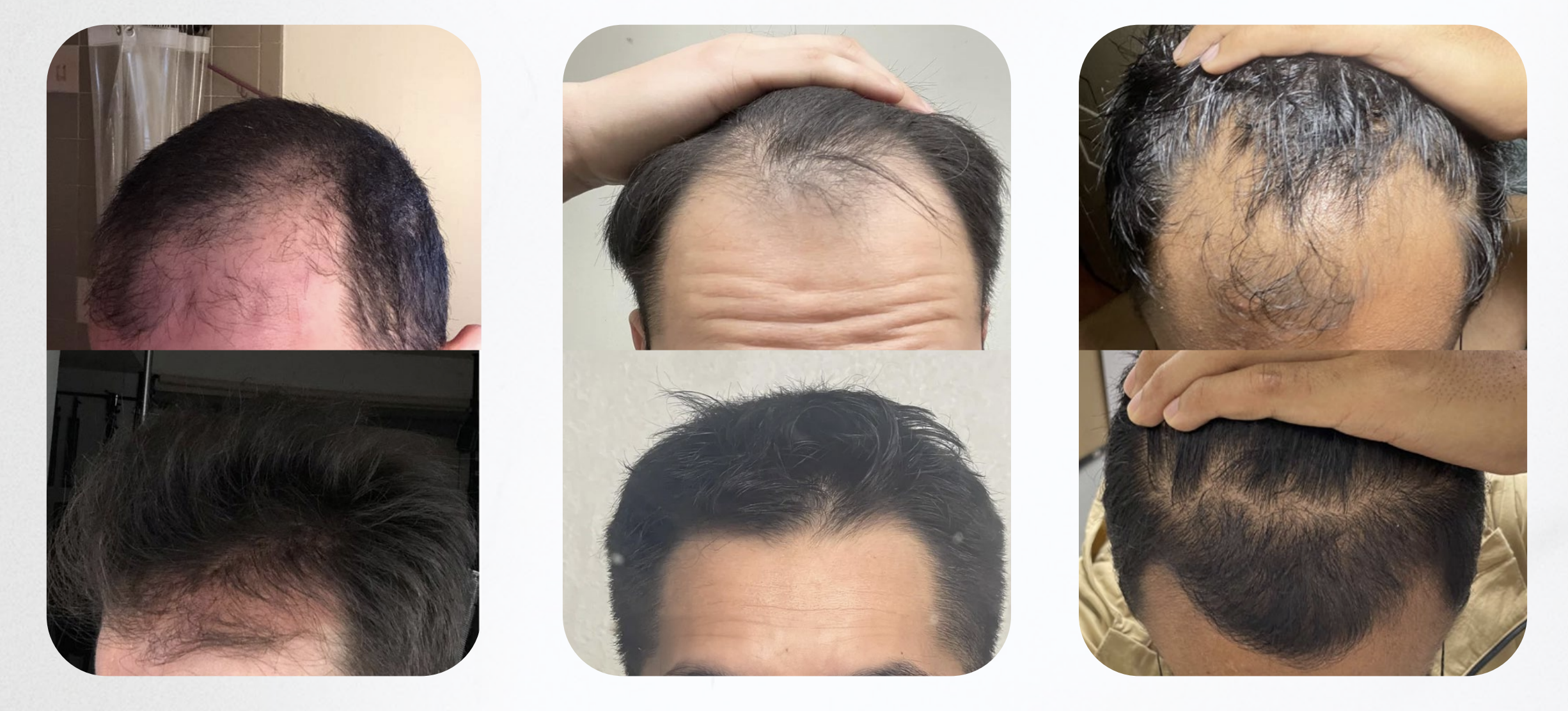 The Mind-Scalp Map: How Emotions Show Up in Hair—and What to Do About ...