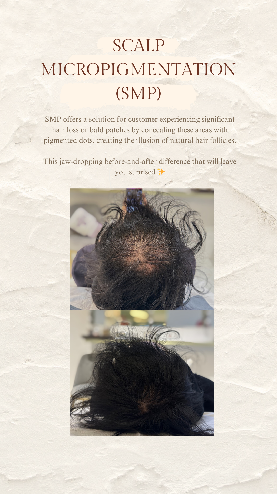 How Hairline Embroidery Changes Your Whole Look (Even if You Don’t ...