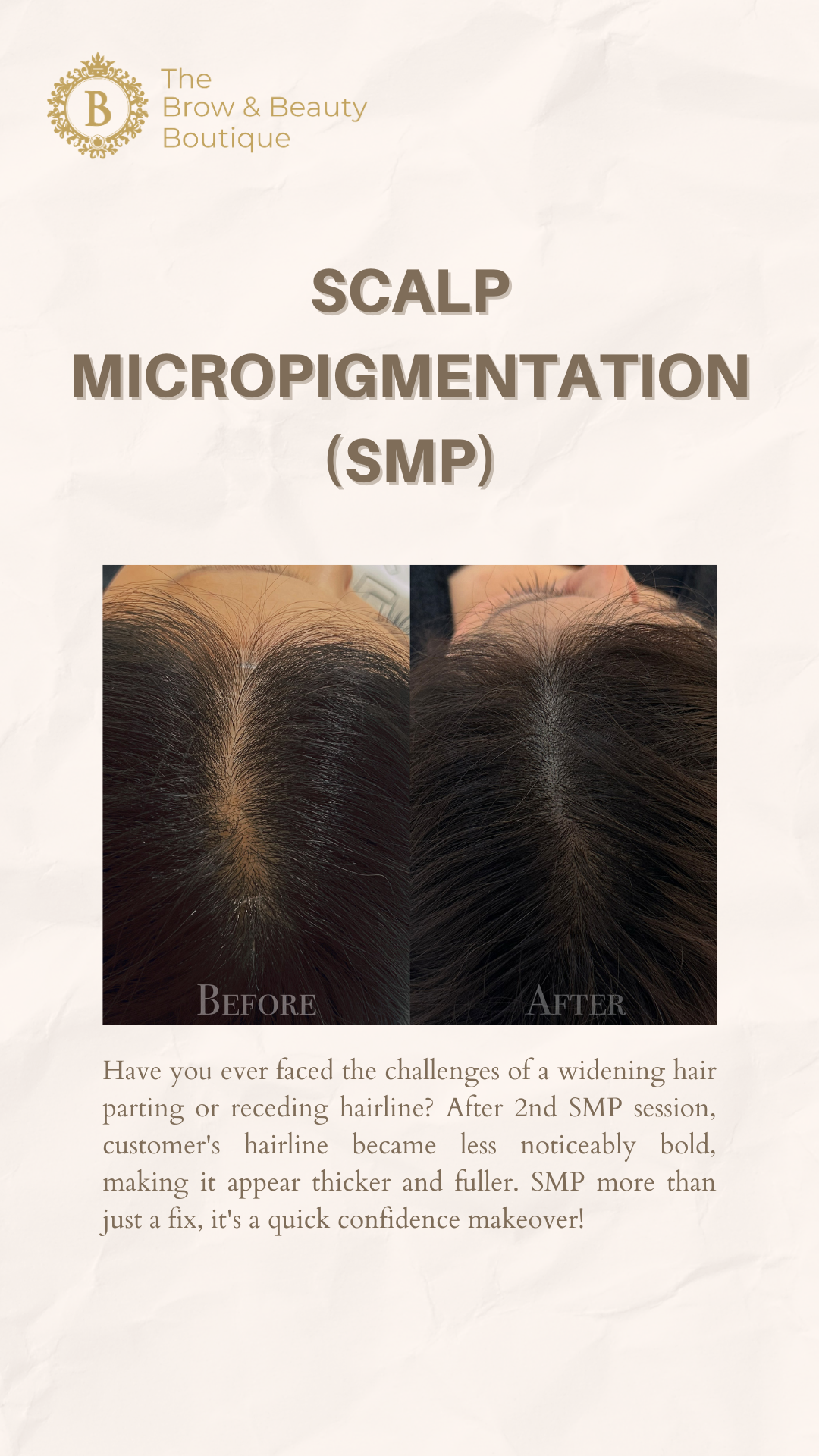 How Hairline Embroidery Changes Your Whole Look (Even if You Don’t ...