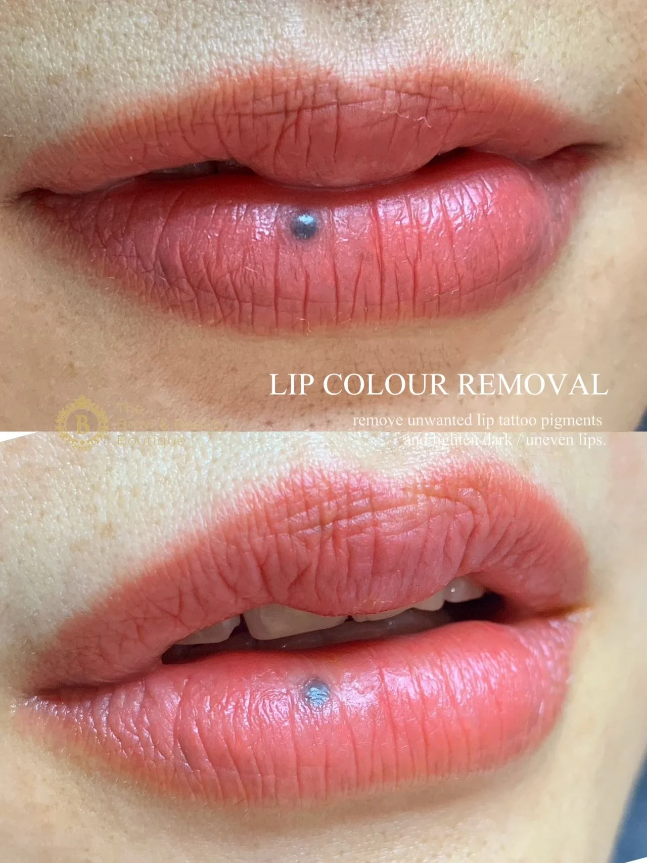 Tired of Pale, Patchy Lips? Here’s How to Bring Back Colour That Lasts ...