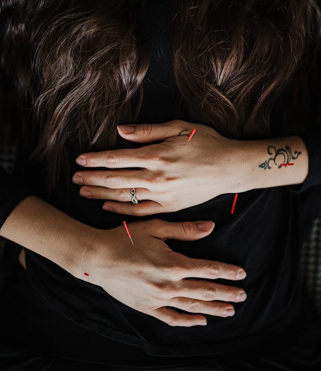 Acupuncture & Traditional Chinese Medicine | St. Charles, Illinois ...