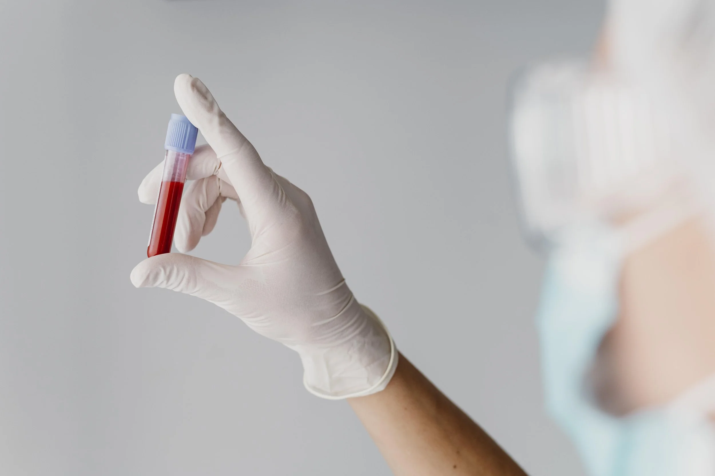 What is insulin and fasting insulin? | NOVI Health