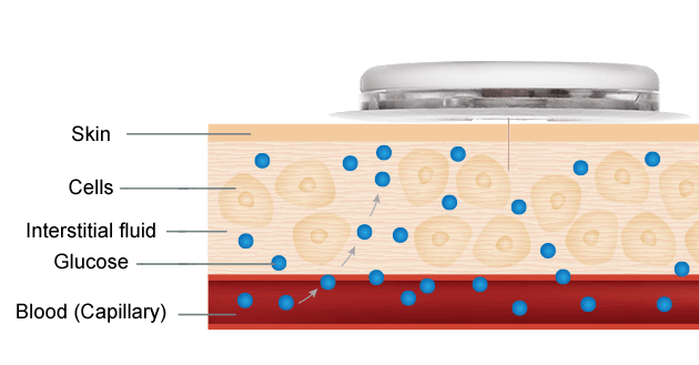 Introduction to Freestyle Libre Sensor | NOVI Health