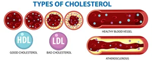 What is Low-Density Lipoprotein (LDL) Cholesterol? | NOVI Health