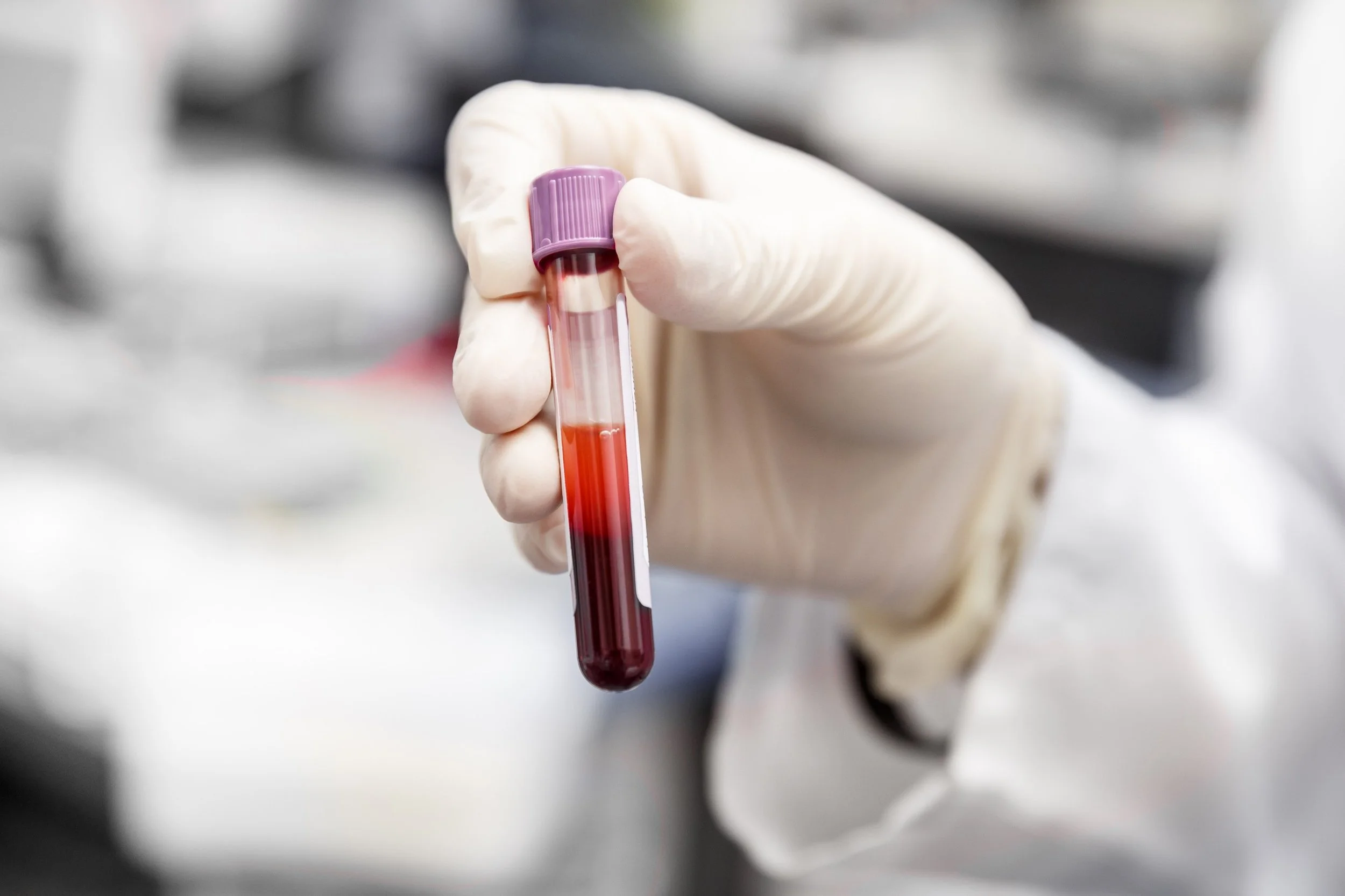 From Good To Great How To Find Your Optimal Blood Glucose Levels