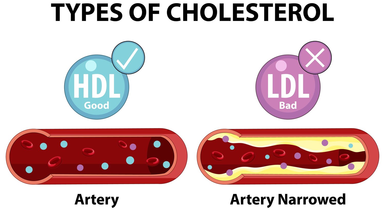 What is High-Density Lipoprotein (HDL) Cholesterol? | NOVI Health