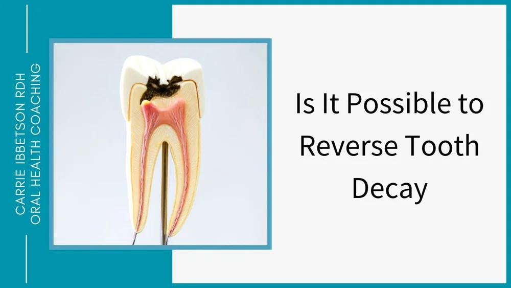 Can Xylitol Reverse Cavities? A Guide to Reversing Tooth Decay — Carrie ...
