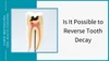 Can Xylitol Reverse Cavities? A Guide to Reversing Tooth Decay — Carrie ...