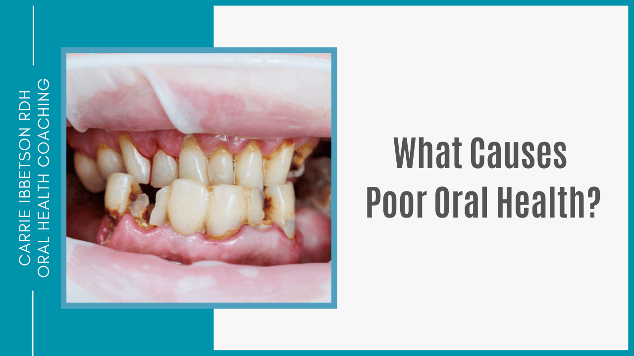 What Causes Poor Oral Health? — Carrie Ibbetson RDH