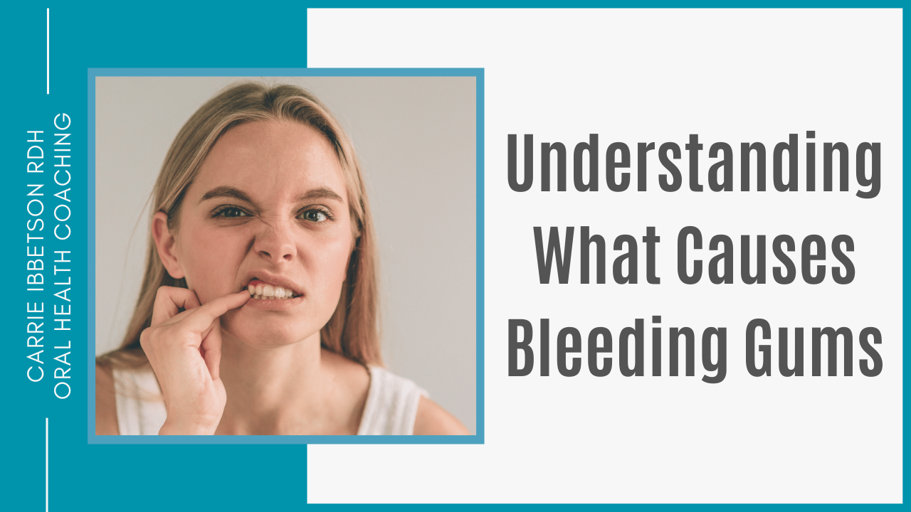 Understanding What Causes Bleeding Gums and How to Address It — Carrie ...