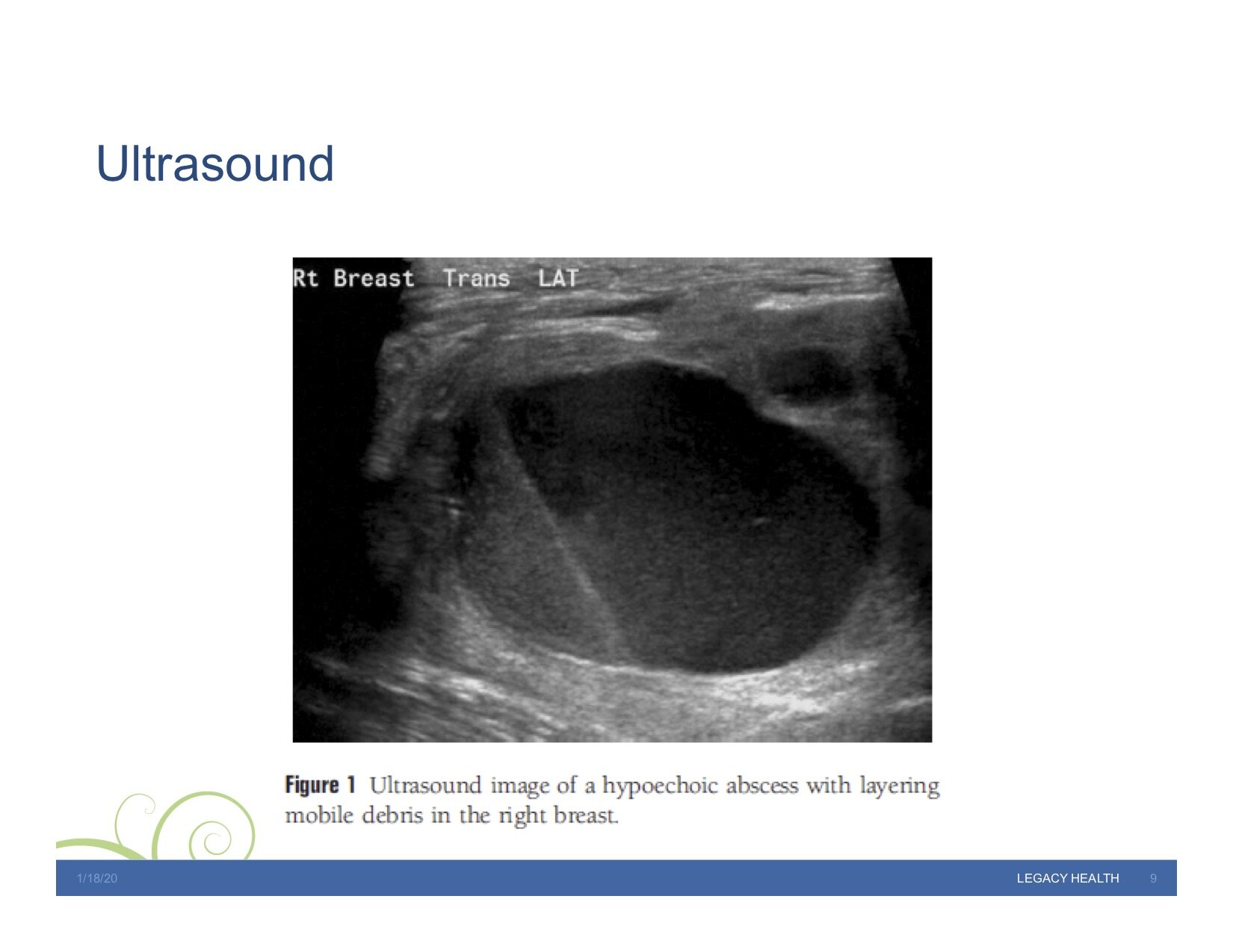 The Surgeon and the Lactating Breast - Cory Donovan MD — Oregon ... The Surgeon and the Lactating Breast - Cory Donovan MD — Oregon ...
