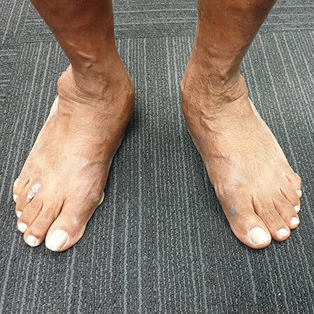 A/Prof Roderick Kuo | Sydney Orthopaedic Foot and Ankle Surgeon