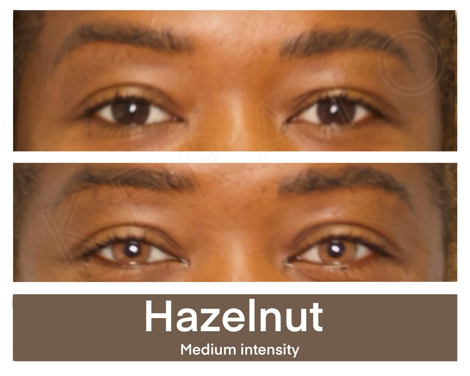 Results and Examples — Eye Color Change — KERATO