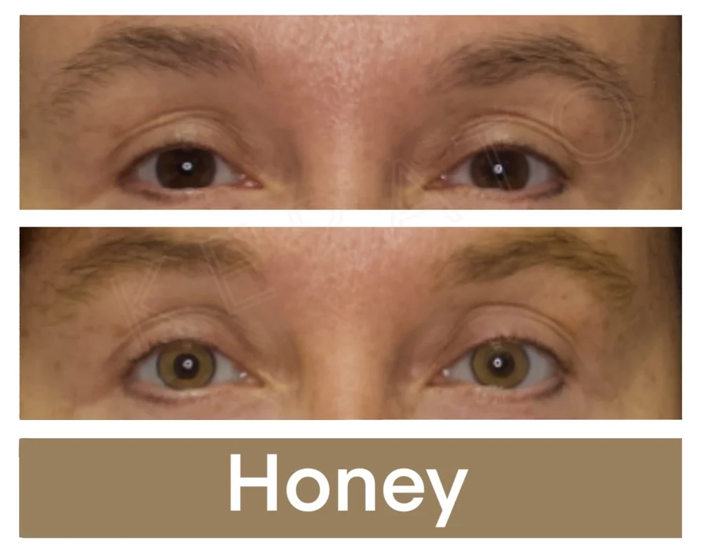 Honey Eyes Before After