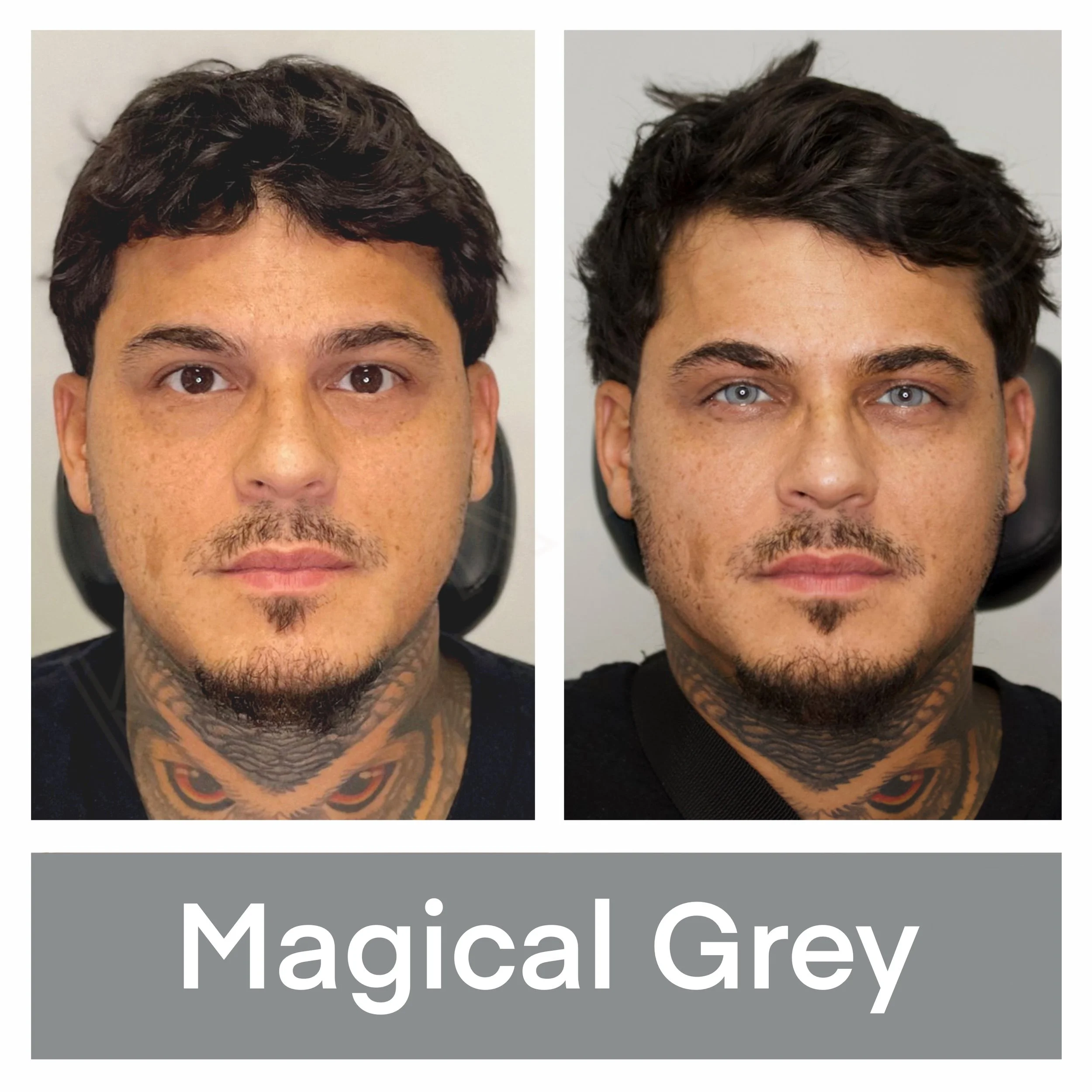 Results and Examples — Eye Color Change — KERATO