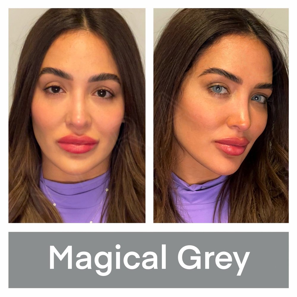 Results and Examples — Eye Color Change — KERATO