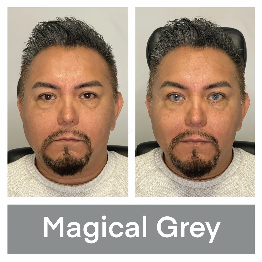 Results and Examples — Eye Color Change — KERATO