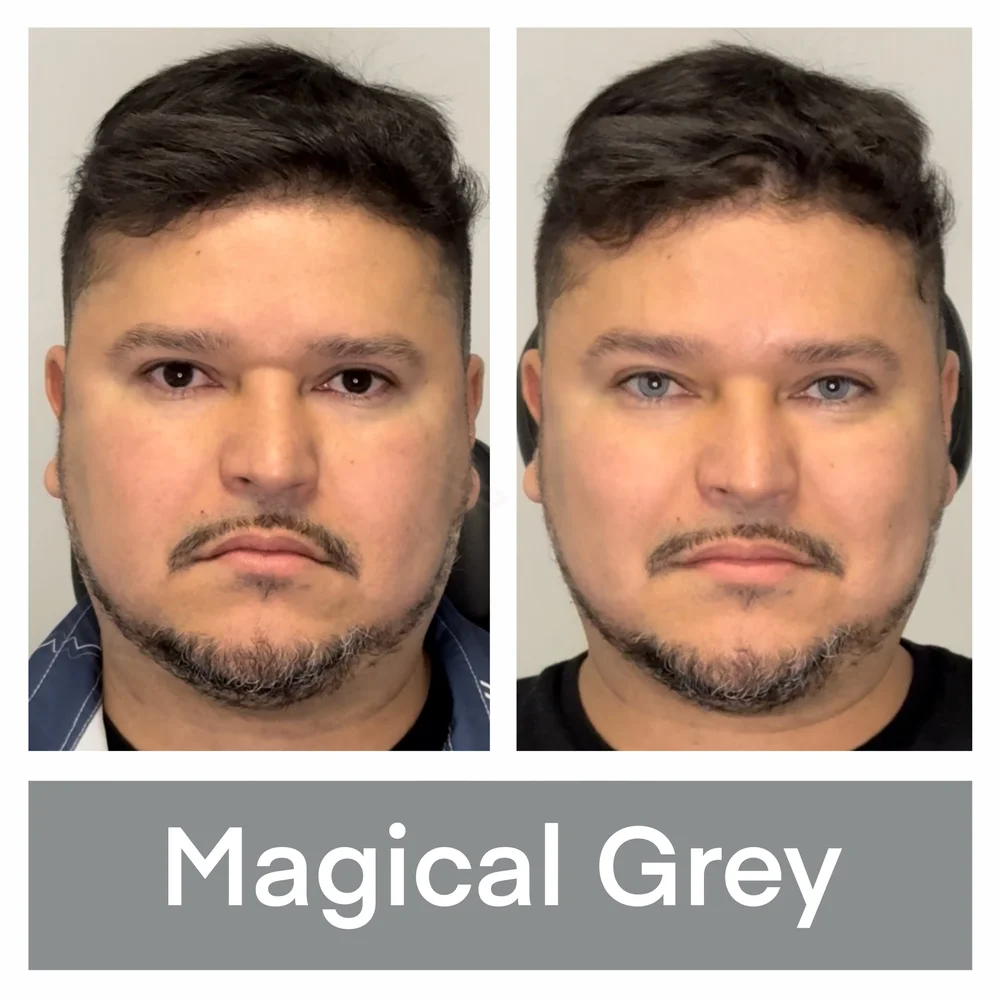 Results and Examples — Eye Color Change — KERATO