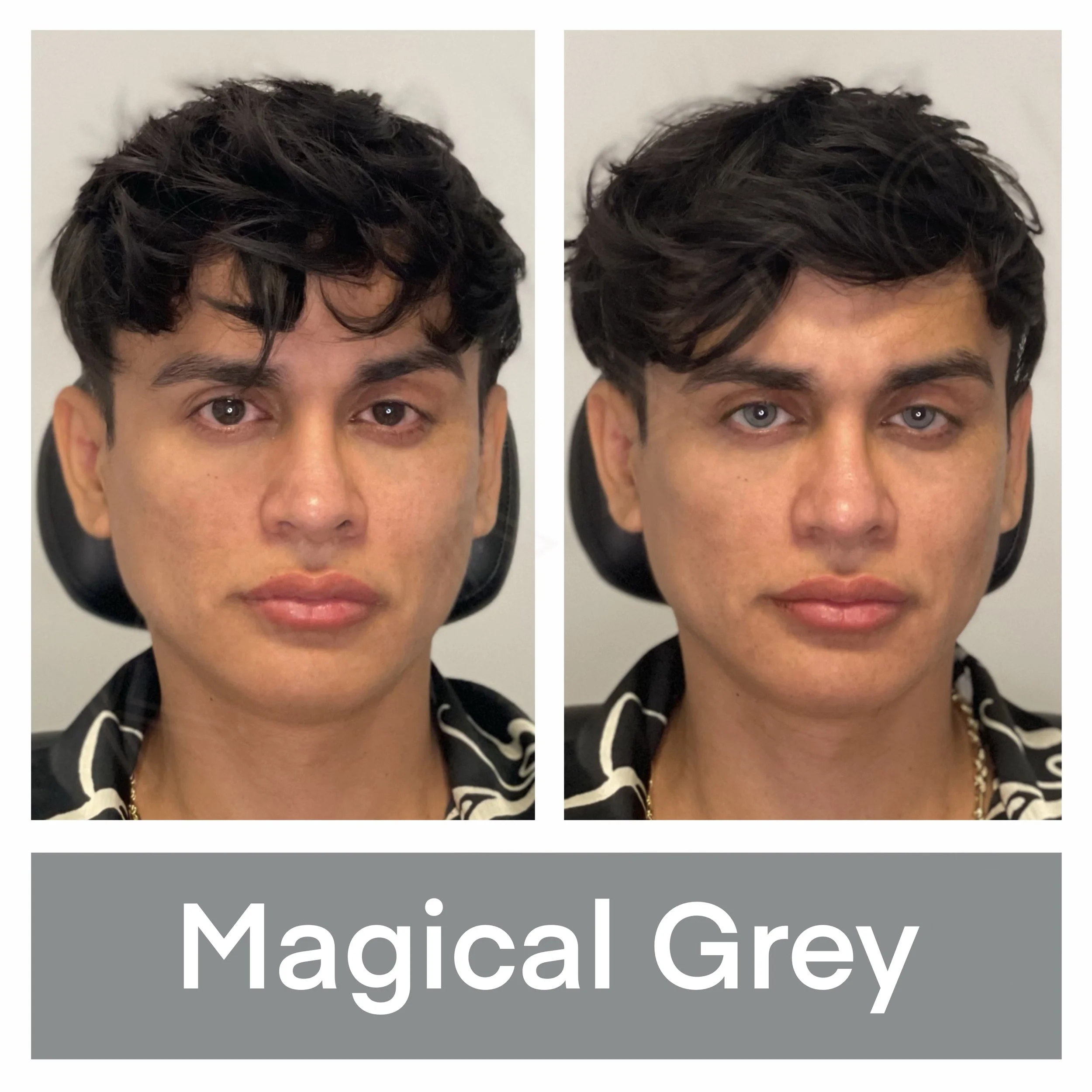 Results and Examples — Eye Color Change — KERATO