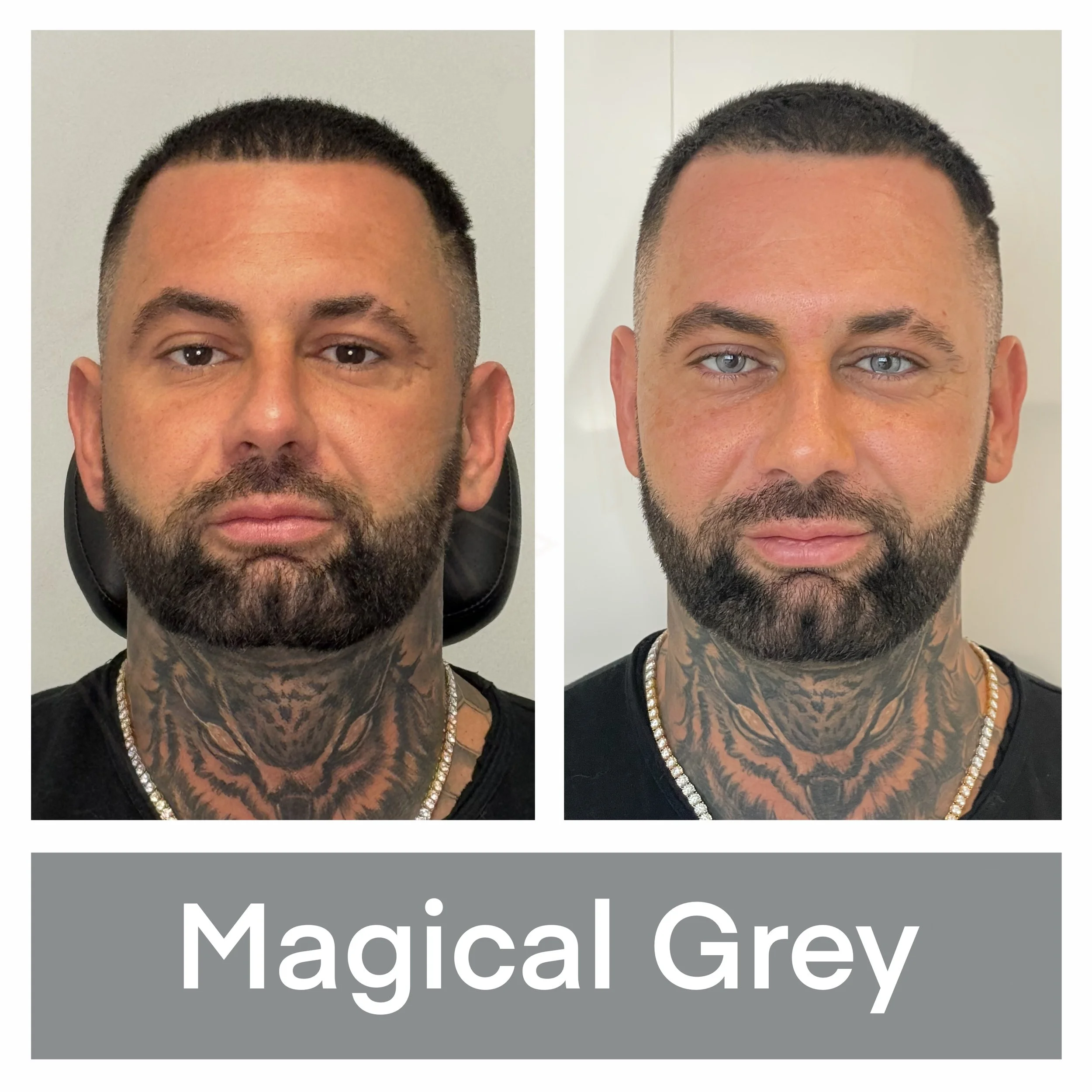 Results and Examples — Eye Color Change — KERATO