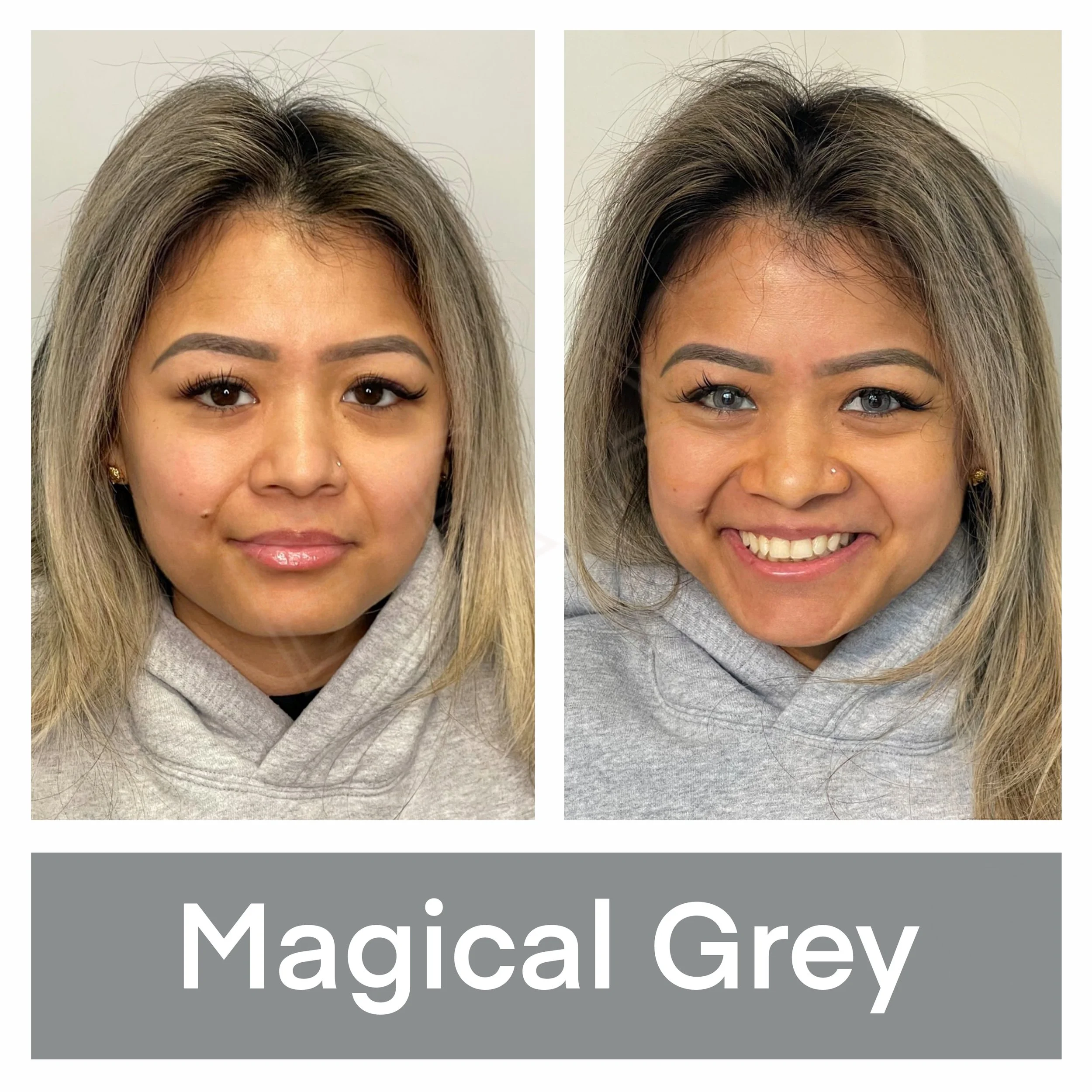 Results and Examples — Eye Color Change — KERATO