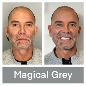 Results and Examples — Eye Color Change — KERATO