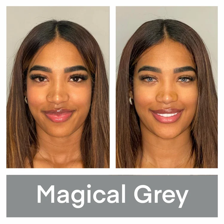 Results and Examples — Eye Color Change — KERATO