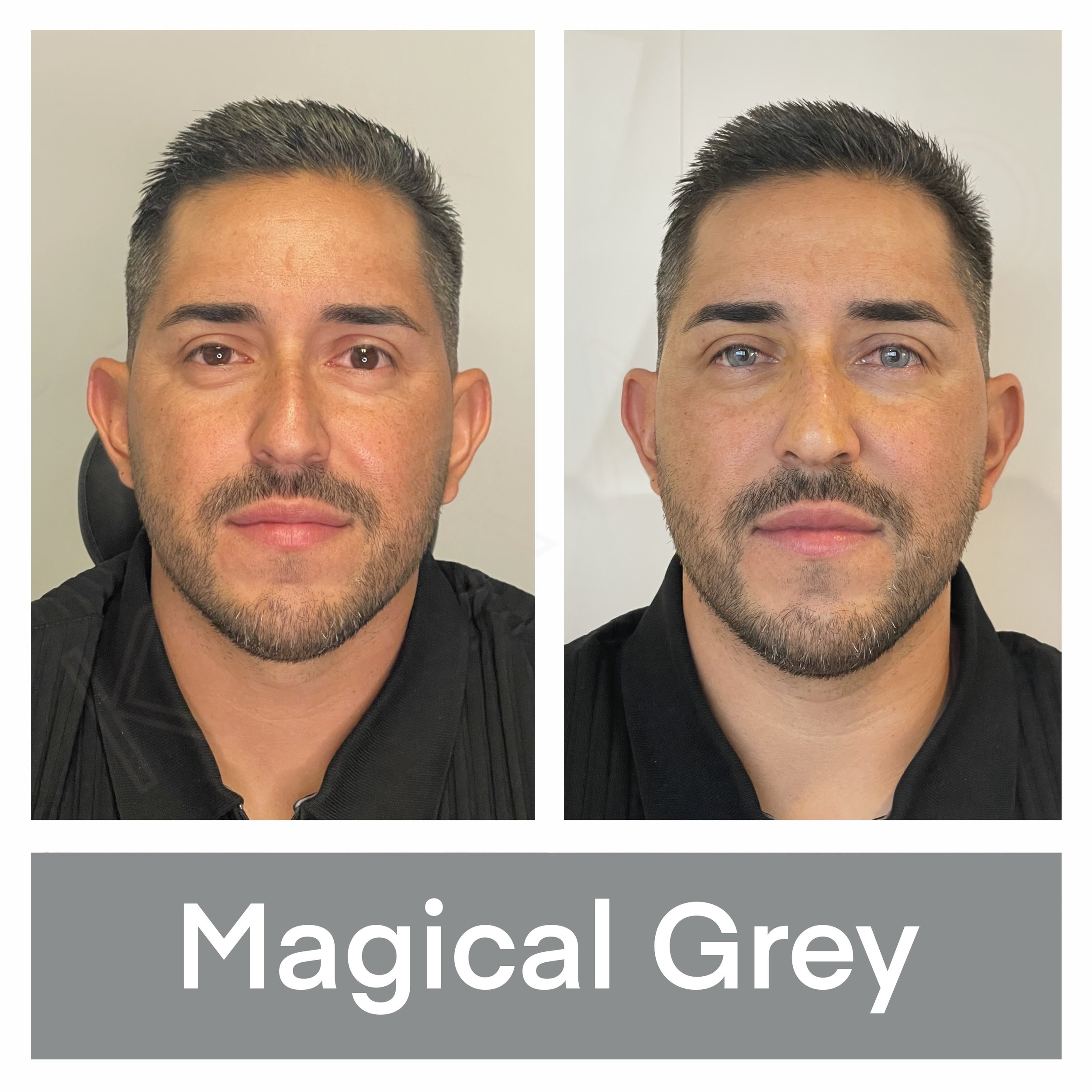 Results and Examples — Eye Color Change — KERATO