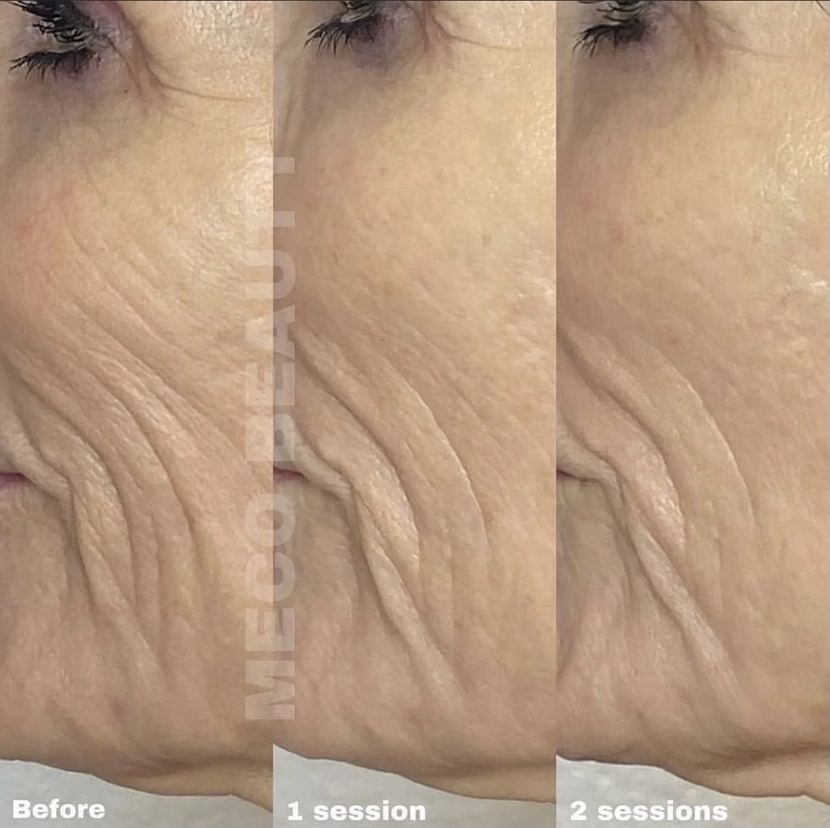 Jet Plasma — WellOK