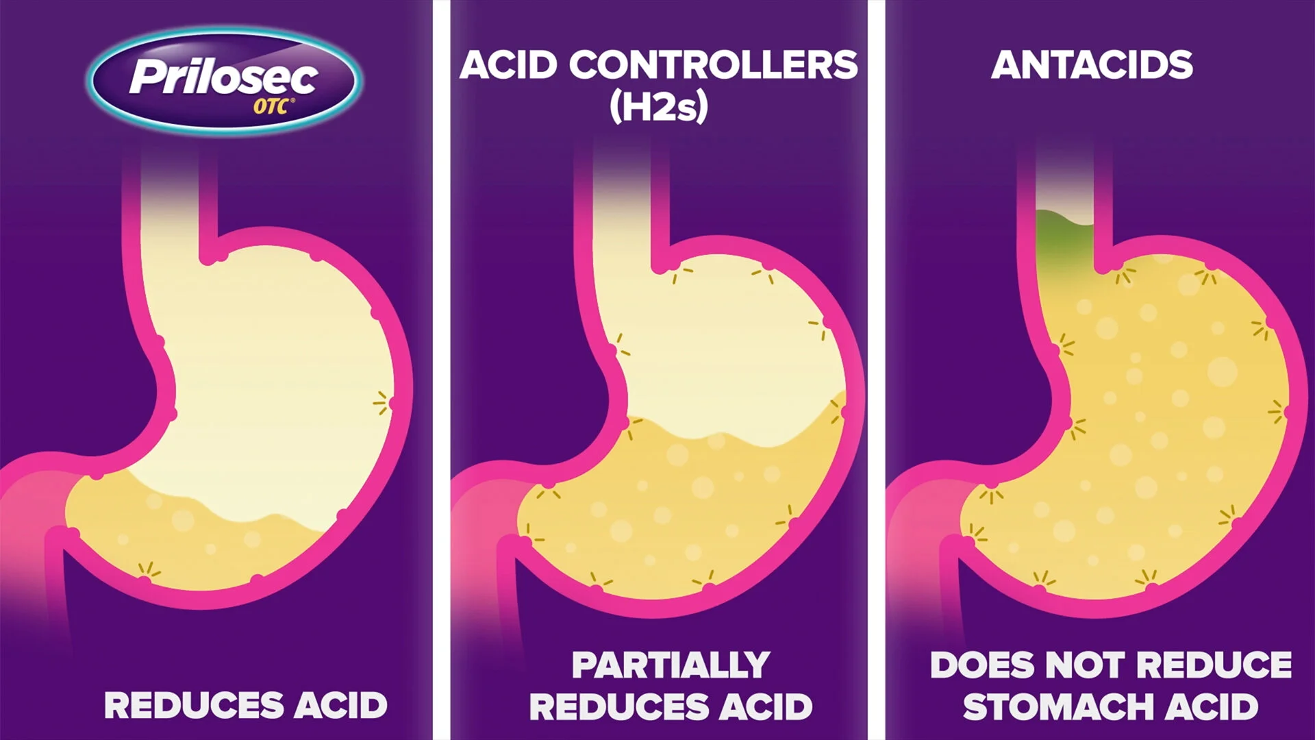 Prilosec OTC — Nolson Design
