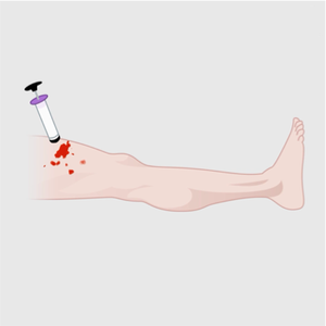XSTAT Technology — OBSTETRX