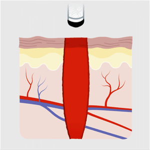 XSTAT Technology — OBSTETRX